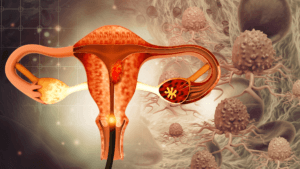 What Are Ovaries? Understanding Their Role in Women’s Health